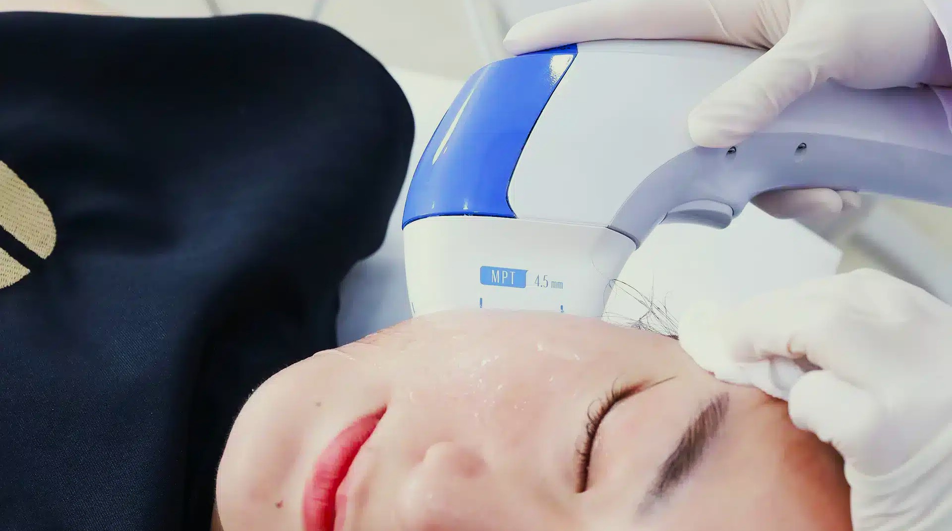 Dra. Flora Martinez - Tecnologias - Ultraformer, Vivace, Lasers Lavieen ...